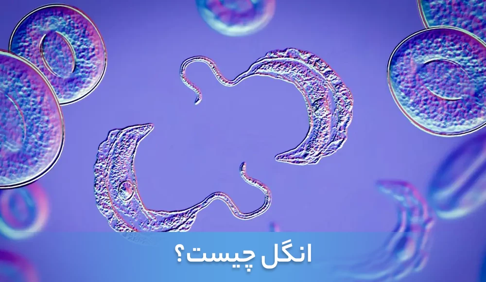 بیماری انگل چیست | علائم و روش های درمان انگل - کلینیک پیکاطب